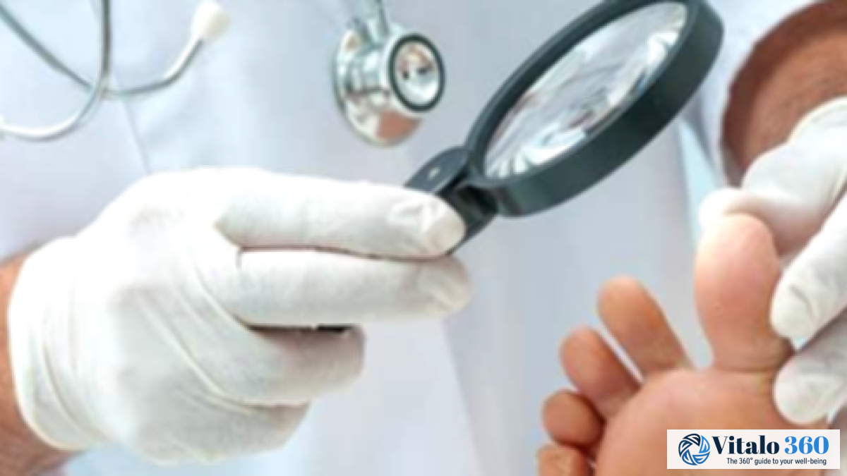 Skin Fungus: Symptoms, Causes, & Treatment Options